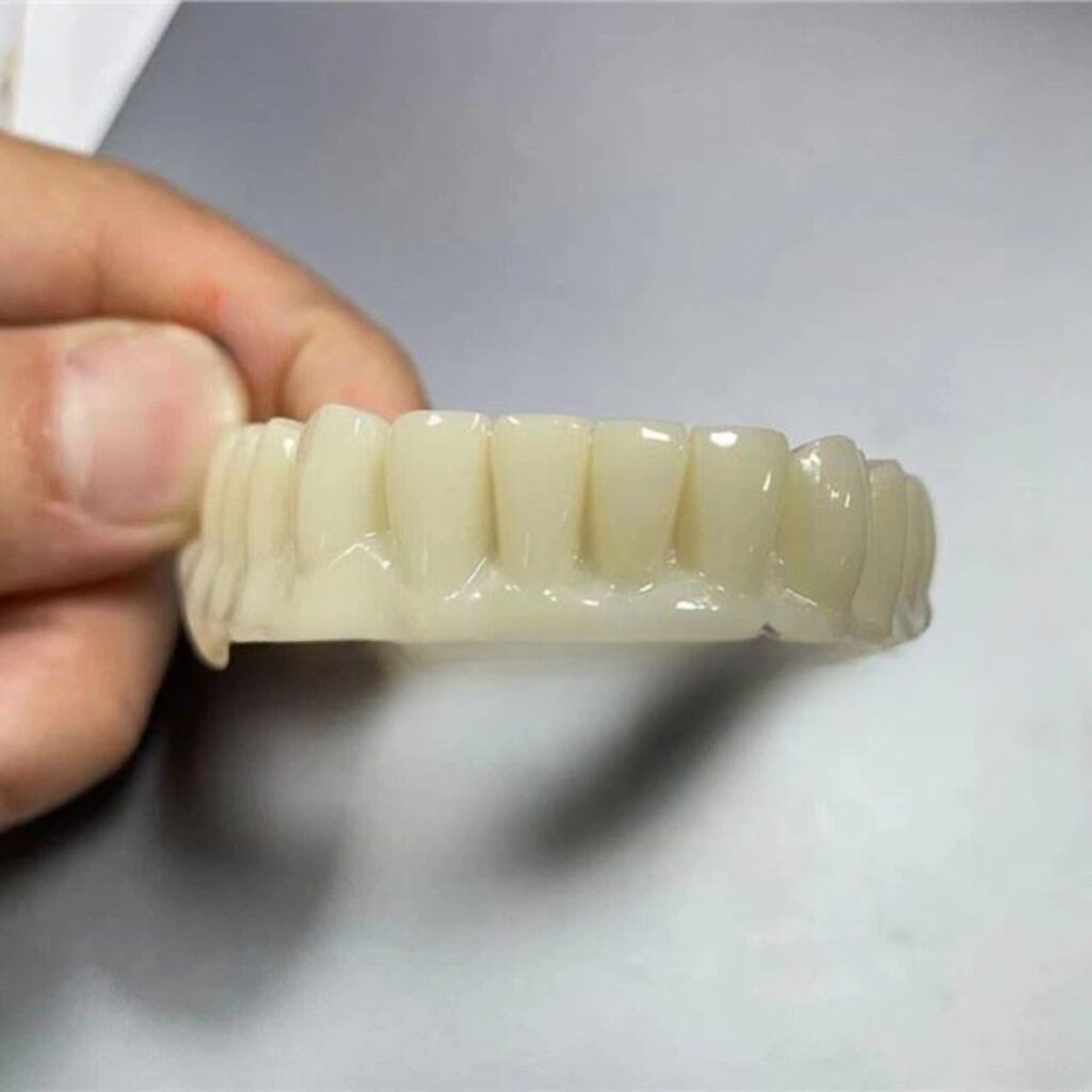 Professional Temporary Crown Design PMMA - Immediate Implant Loading ...